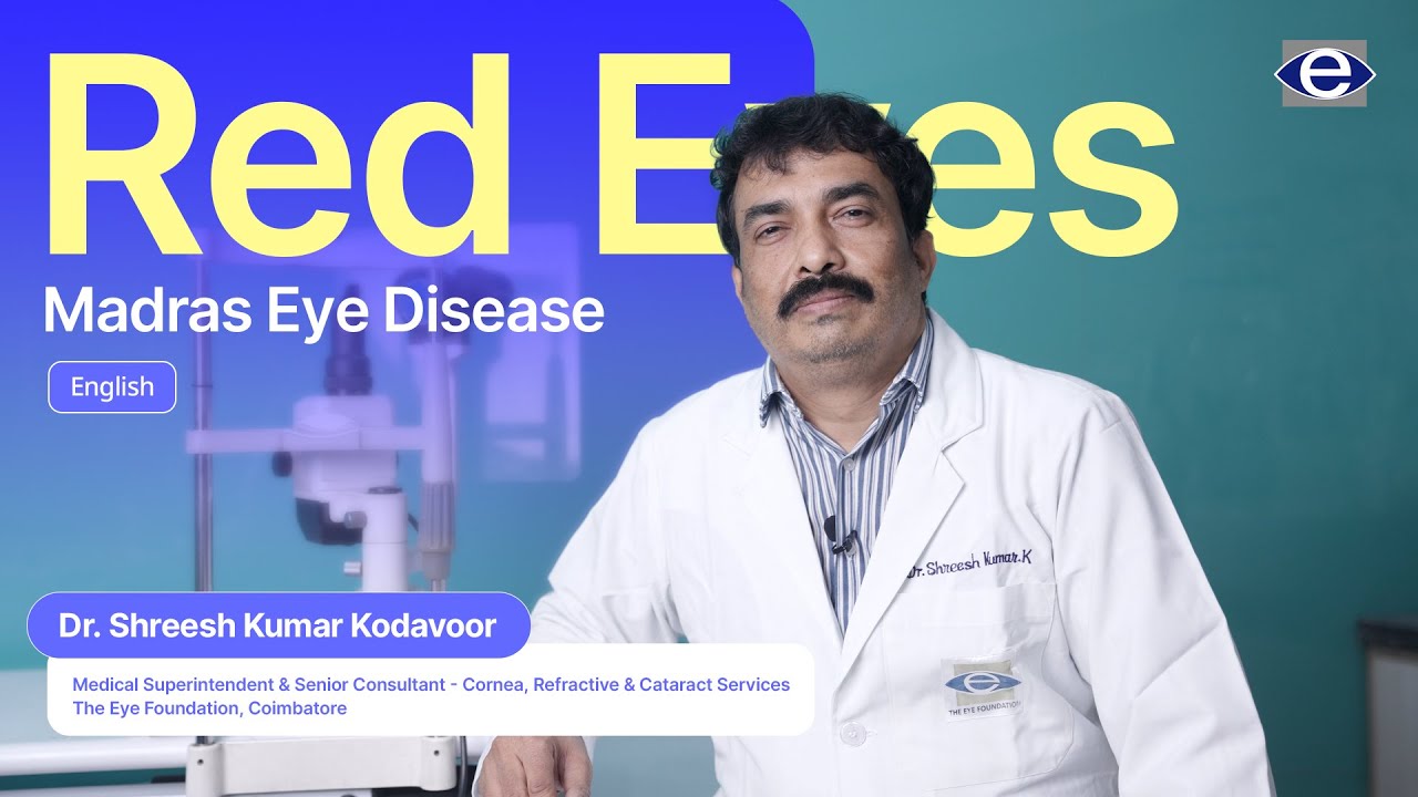 Madras Eye Disease | Common Eye Conditions | The Eye Foundation | # ...