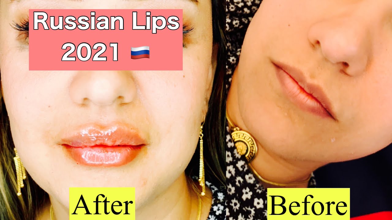 Russian Lips - With Before and After - YouTube