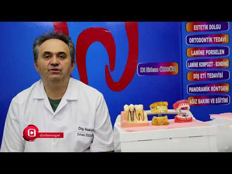 Diş çekimi nedir hangi durumlarda diş çekimi yapılmalıdır - Tooth extraction