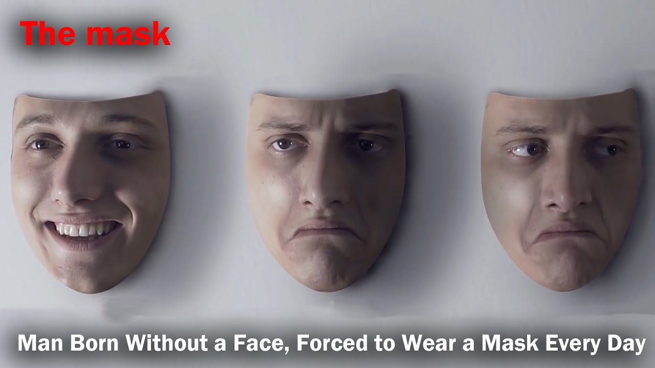 Man Born Without a Face, Forced to Wear a Mask Every Day - YouTube