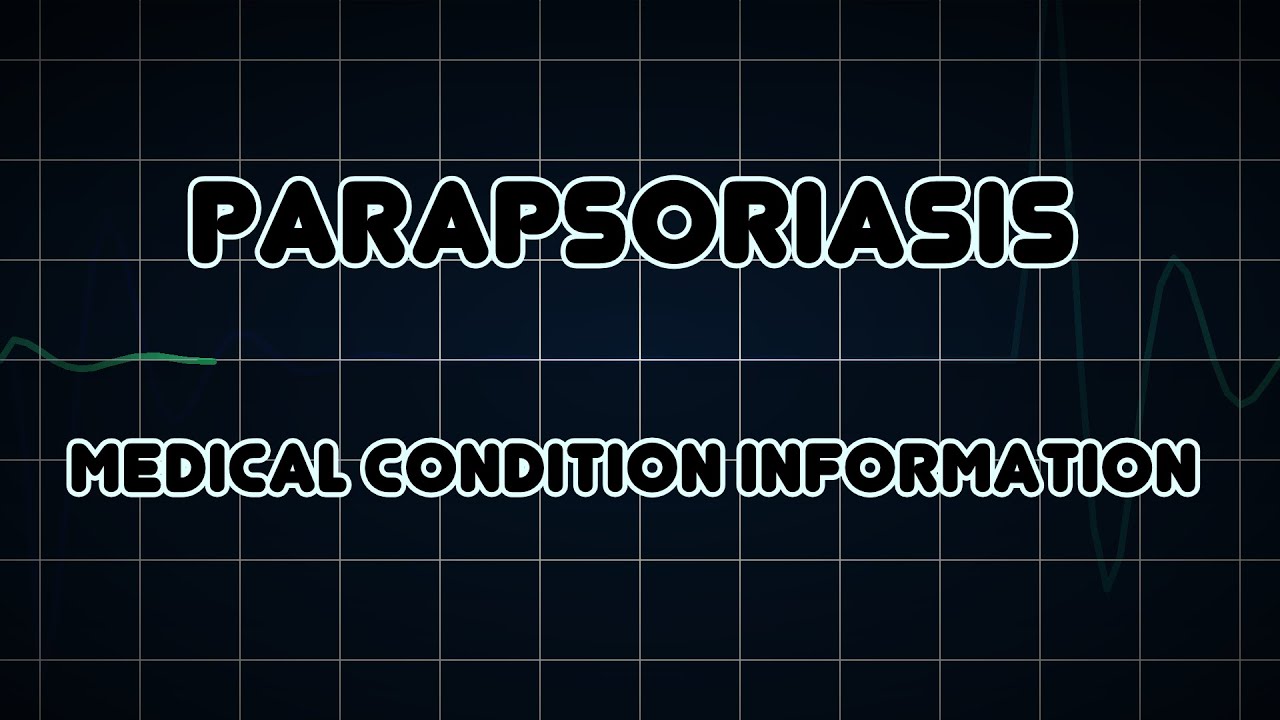 Parapsoriasis (Medical Condition) - YouTube