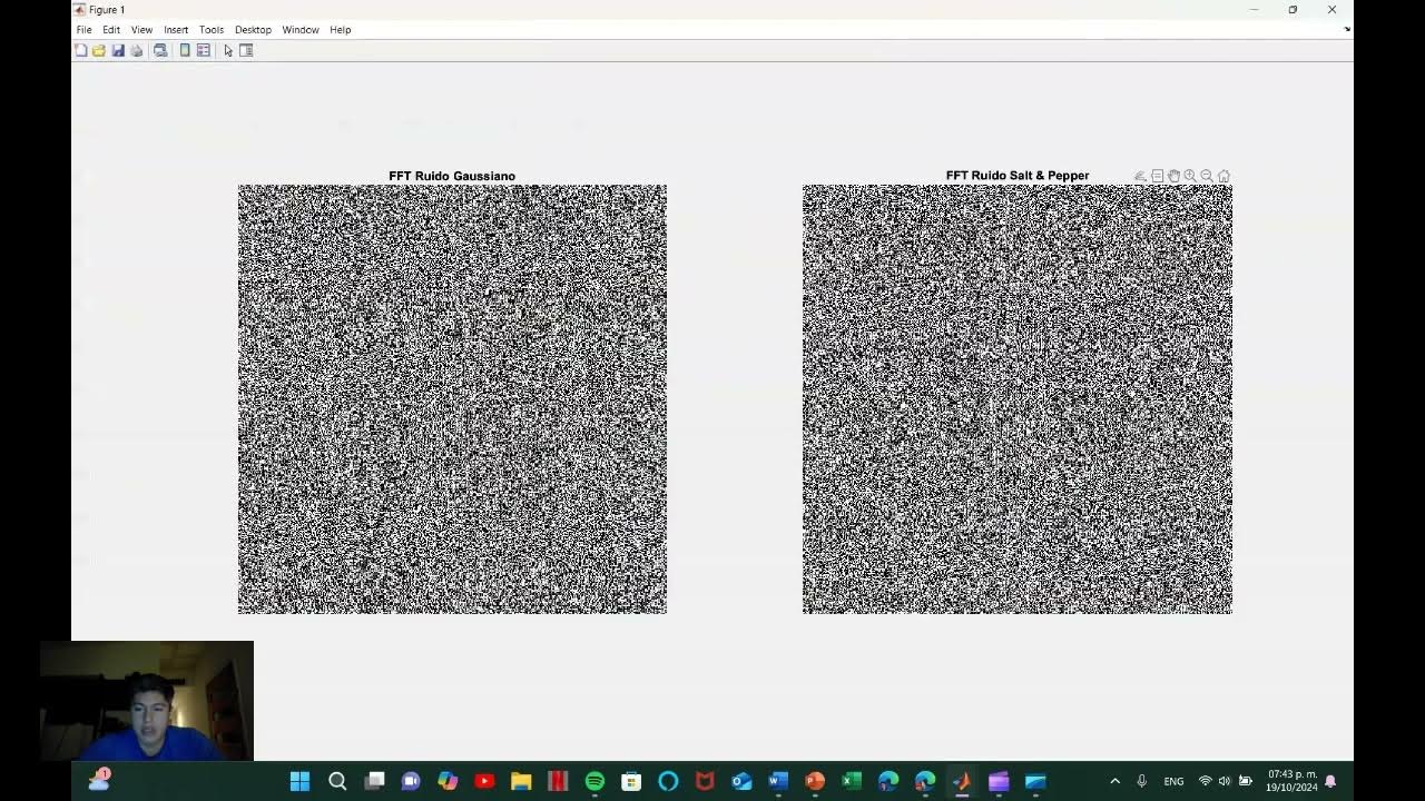 Práctica 7: Filtrado de Imágenes Médicas en el Dominio de la Frecuencia ...