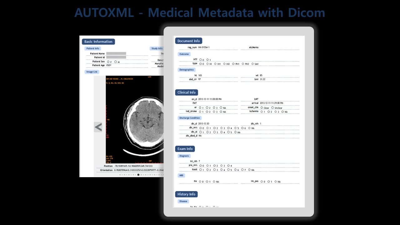 3KBICAS : AUTOXML - Medical Metadata with Dicom - YouTube