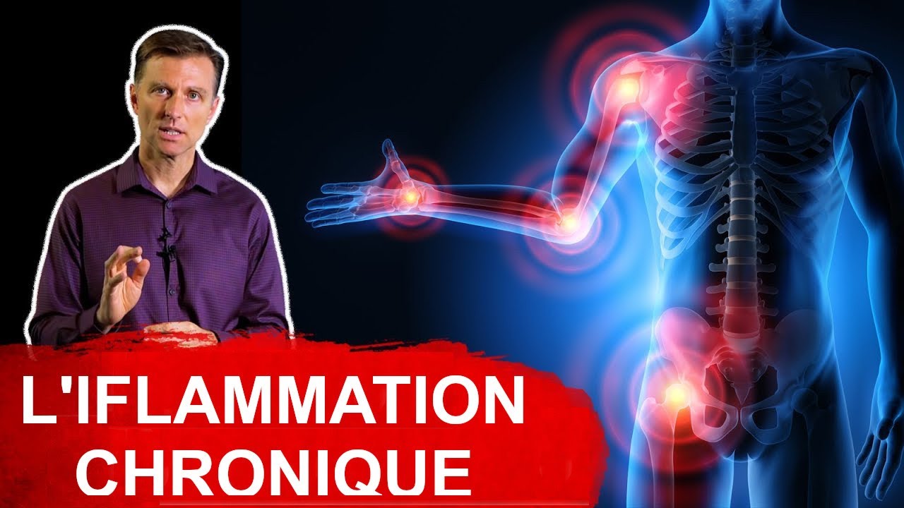 Les Gros Problèmes De L'Inflammation Chronique...Et Les Solutions. l Dr ...