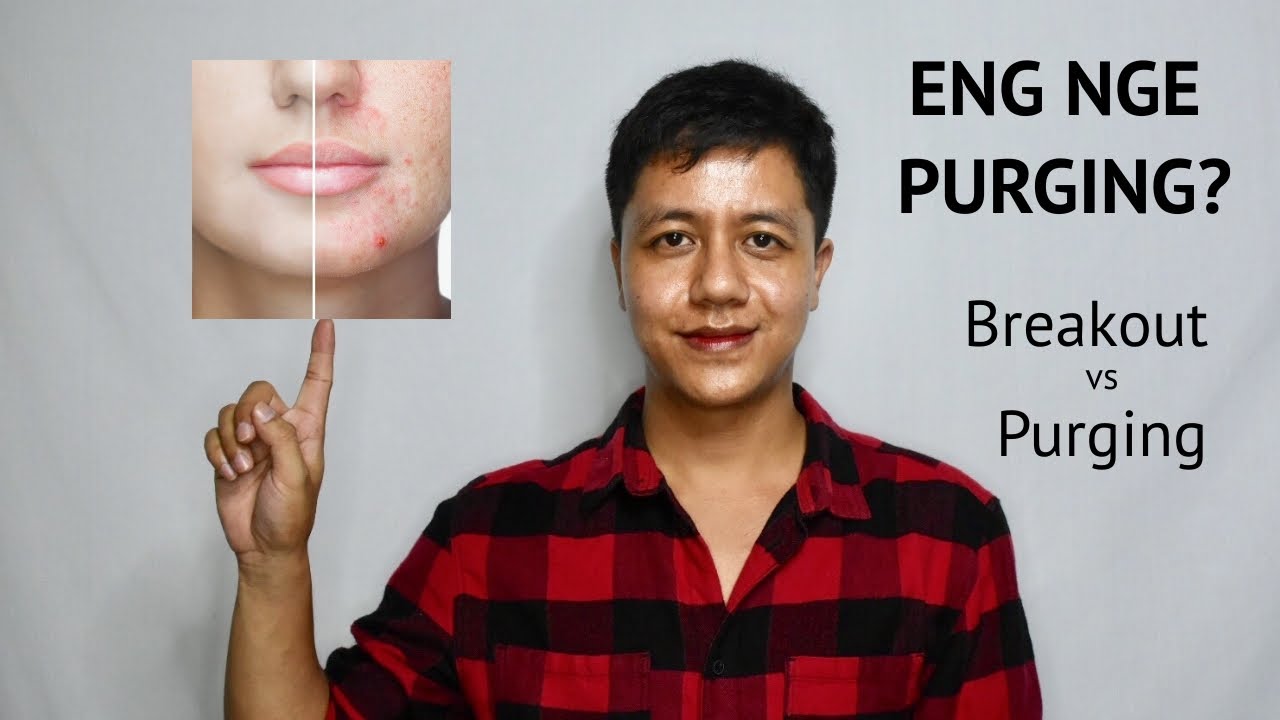 Purging - Eng nge Purging [With Subtitle]/ What is purging? - YouTube