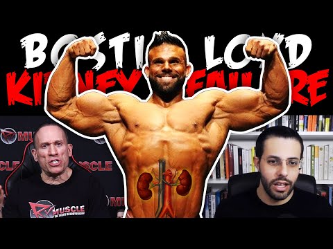 Bostin Loyd Is In Kidney Failure - How To Stay Safe While Bodybuilding (or at least safer)