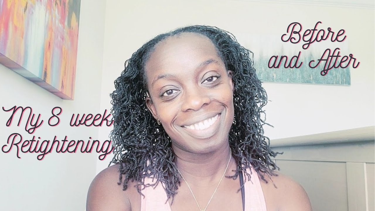 My 8 week Retightening | Before and After!! - YouTube