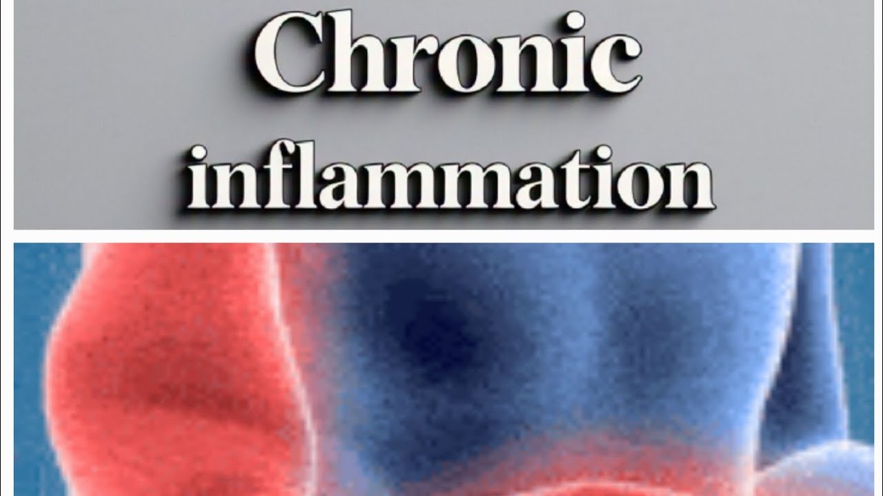 Chronic Inflammation animation Definition Cause Solution #pathology ...