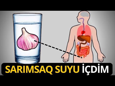 7 Gün Sarımsaq Suyu İçdim - Görün Başıma Nələr Gəldi...