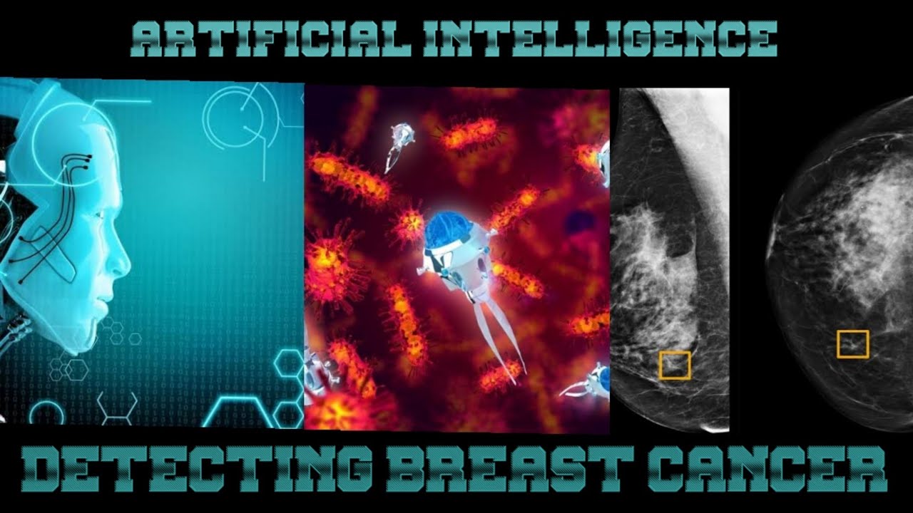 Advance Breast cancer detection method | Artificial intelligence ...