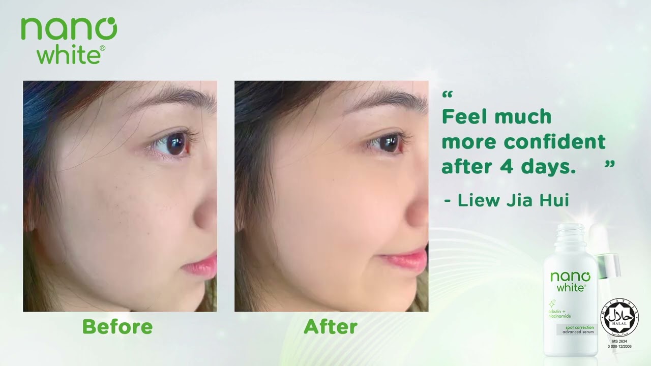 Nanowhite Spot Correction Advanced Serum - Before & After - YouTube