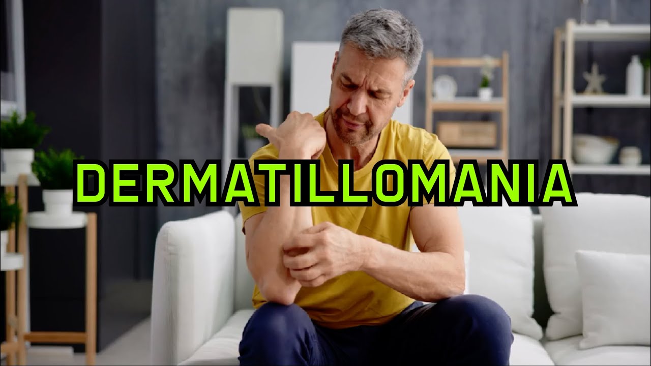 3-Minute Explanation: Dermatillomania (Excoriation Disorder - Skin ...