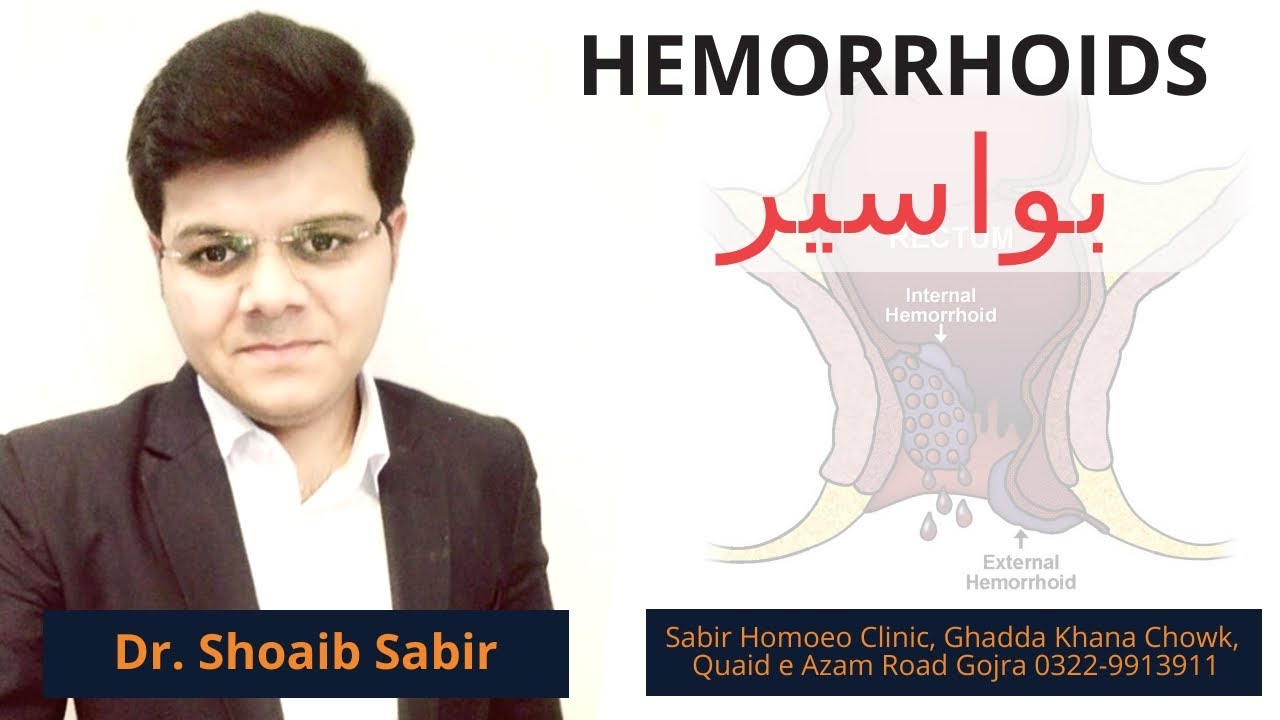 HEMORRHOIDS or BAWASEER, types (Baadi or Khooni) Symptoms & its ...