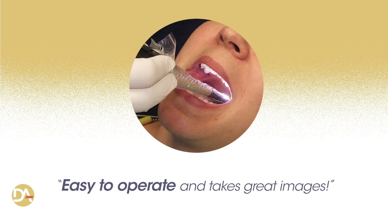 2019 Award Video Digital Doc IRIS Intraoral Camera - YouTube