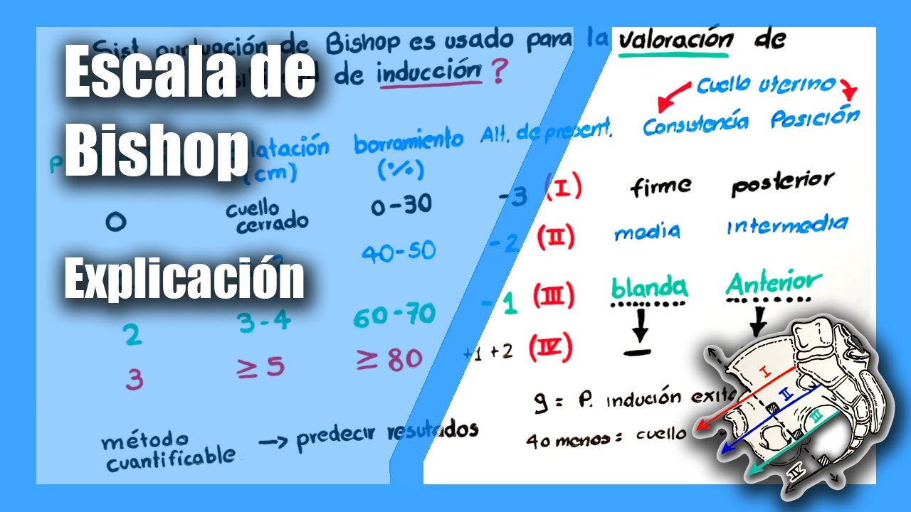 Escala de Bishop (explicación) | Ginecología y obstetricia - YouTube