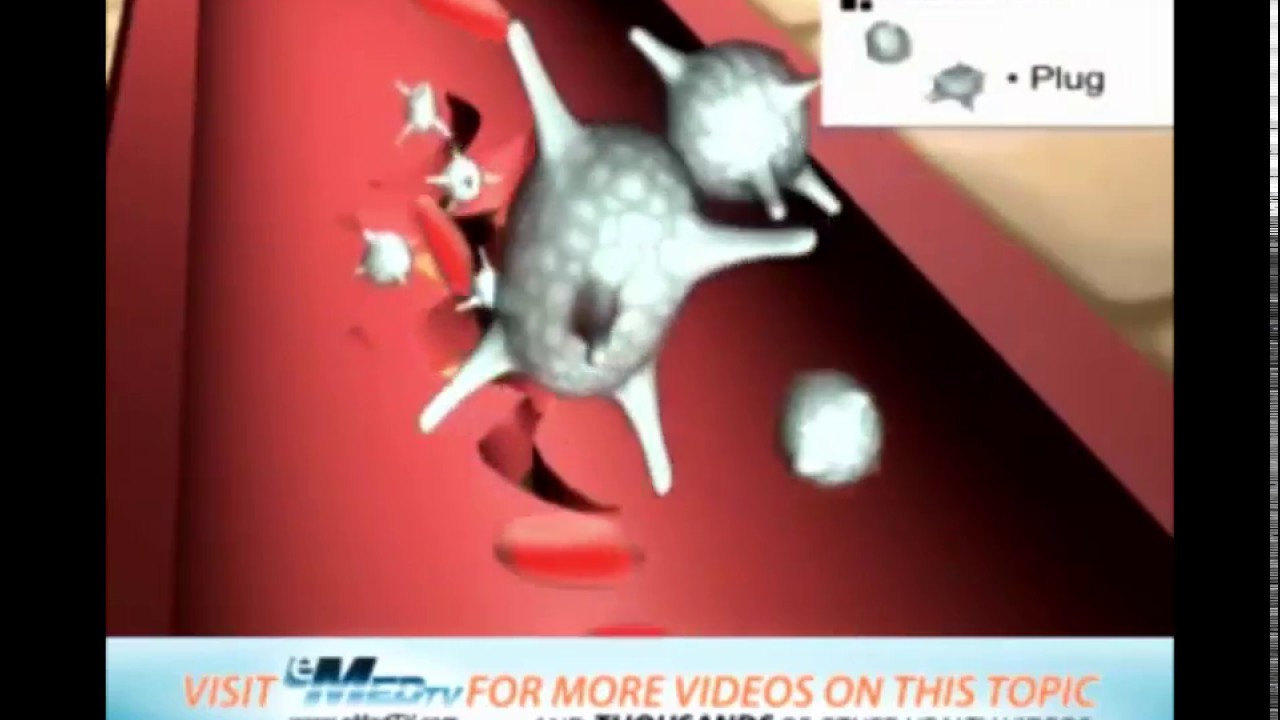 6.3 - Defense against infectious diseases (1/2) - YouTube