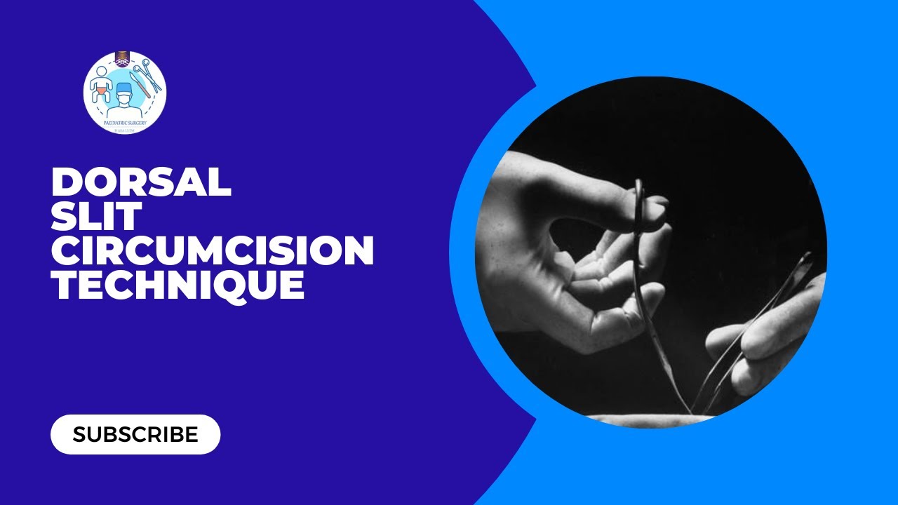 DORSAL SLIT TECHNIQUE - YouTube