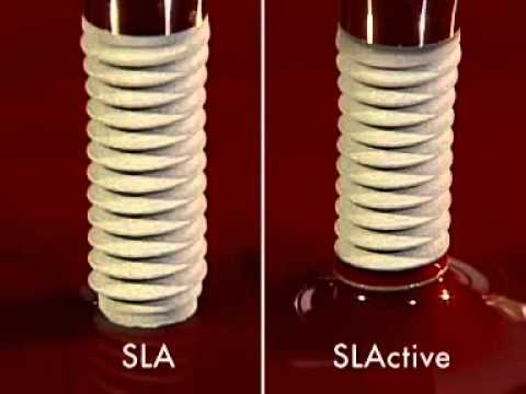 SLA e SLActive - YouTube