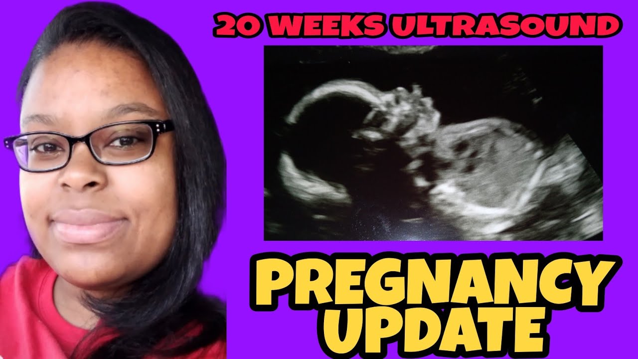 PREGNANCY UPDATE #4 | COME WITH ME TO MY 20 WEEK ULTRASOUND APPOINTMENT ...