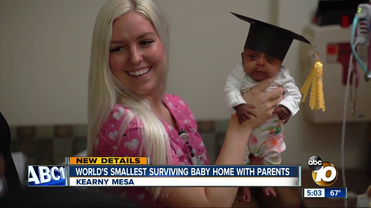 World’s smallest surviving baby born at San Diego hospital - YouTube