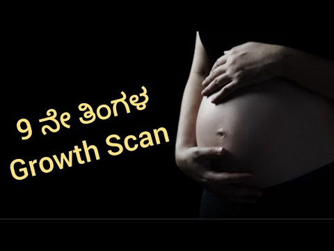 9th month Growth Scan | Baby Growth Scan | Final Growth Scan of baby # ...