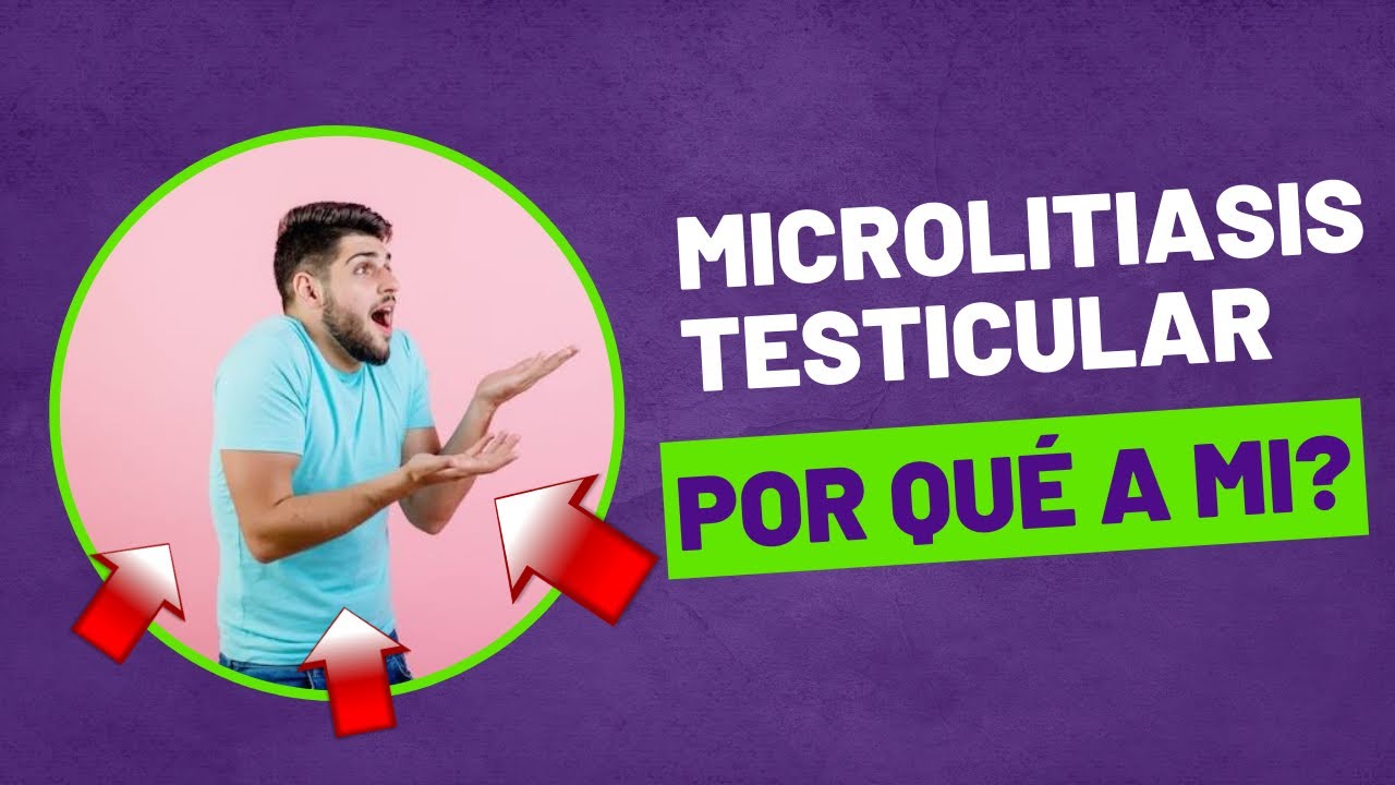 MICROLITIASIS TESTICULAR ️ - YouTube