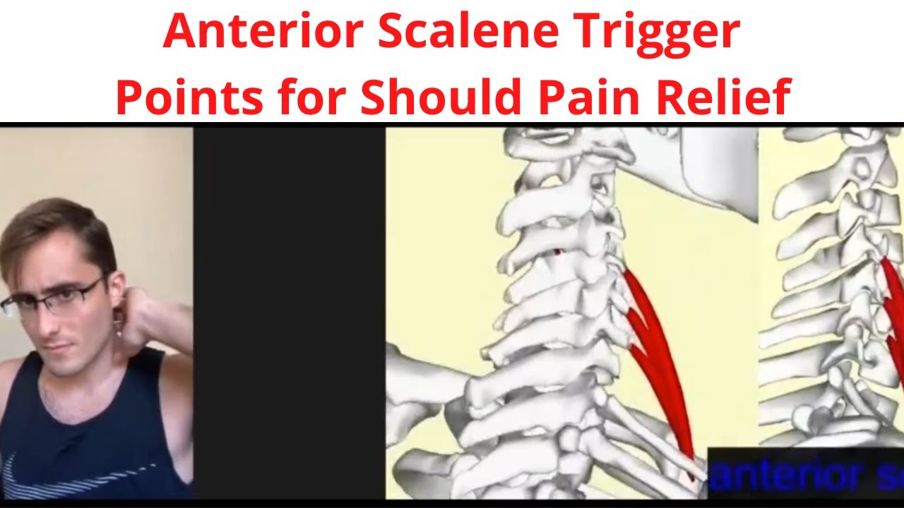 Anterior Scalene Trigger Points for Shoulder Pain Relief - YouTube