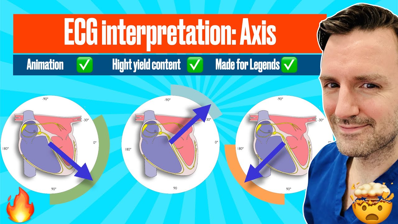 Cardiac Axis! A visual guide - YouTube
