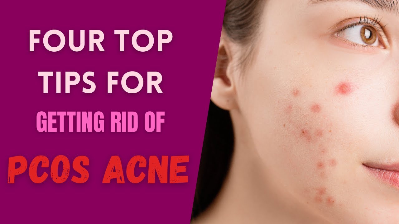 4 Tips To Naturally Reverse Hormonal Acne (Insulin Resistance + High ...