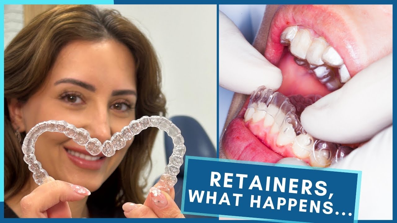 How Retainers Keep Your Teeth Straight After Braces? - YouTube