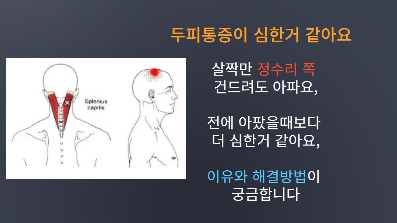 두피통증 정수리통증의 원인Causes of scalp pain parietal pain - YouTube