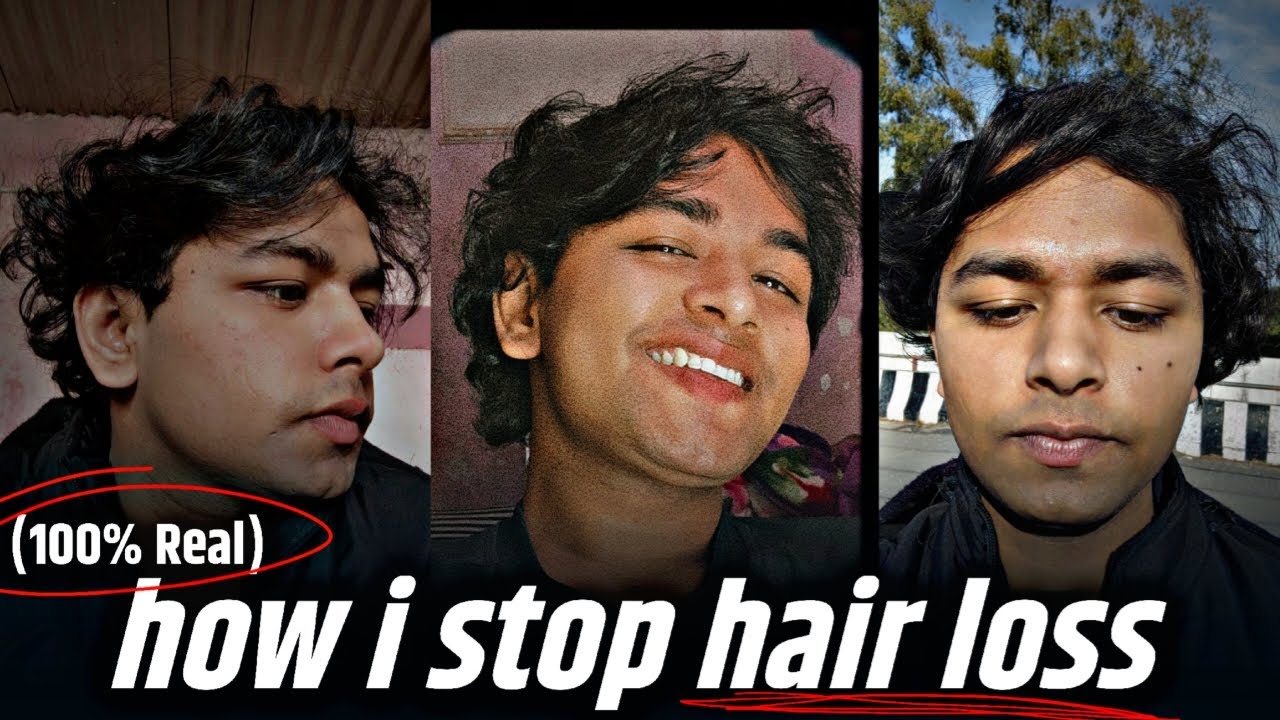 How I stop hair loss (100% real my journey) | How to stop hair loss ...