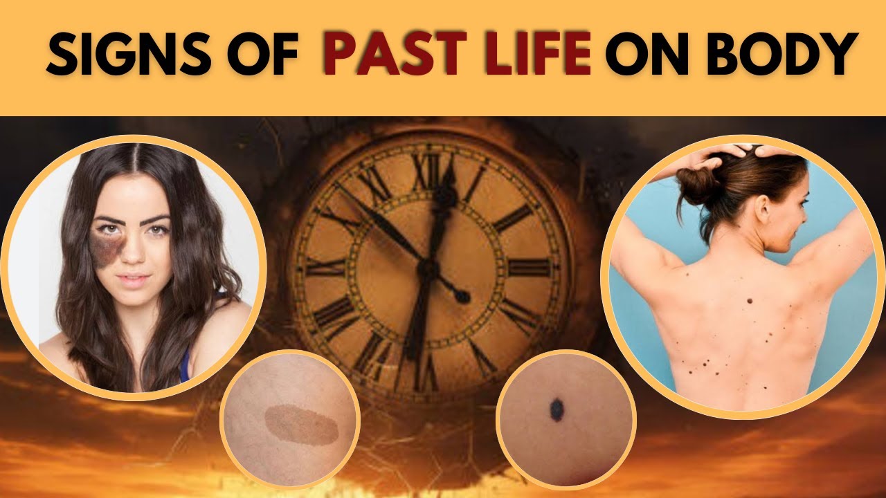 Signs Of Past Life Birth | Birth Mark | Punar Janam Ka Sach | Rebirth ...