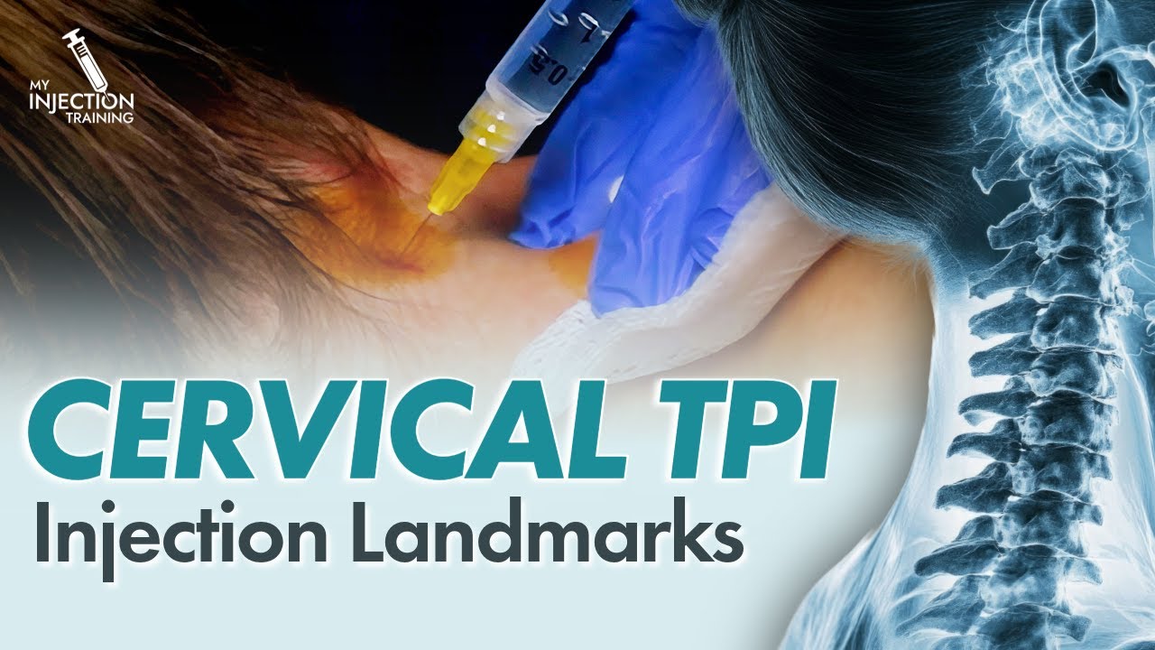 How to Perform Cervical Paraspinal Trigger Point Injections - YouTube