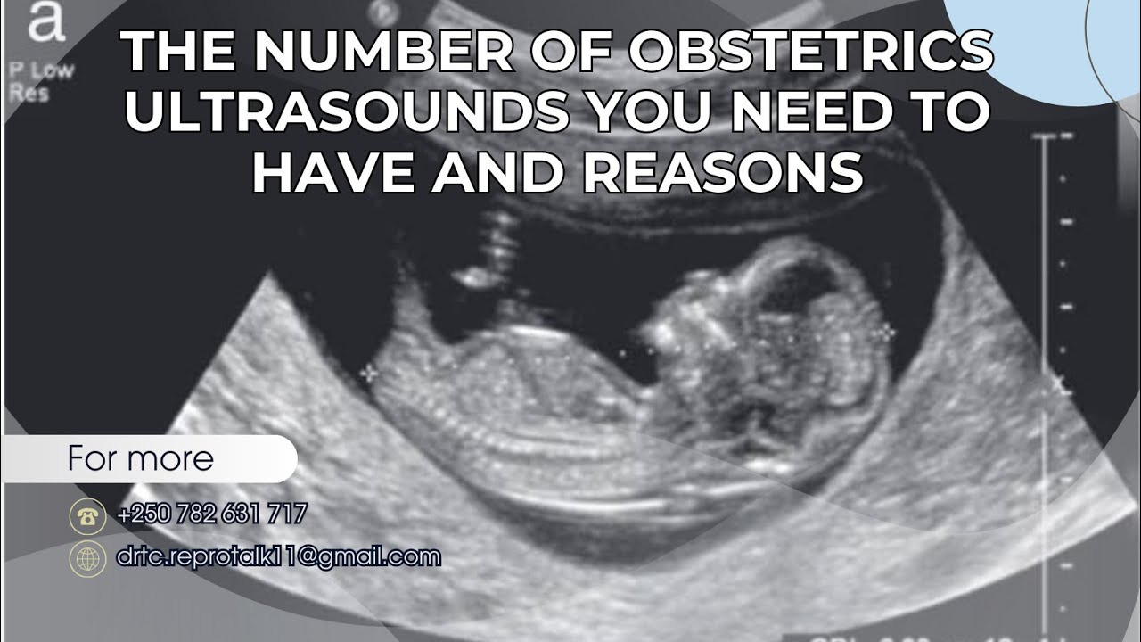 THE NUMBER OF OBSTETRICS ULTRASOUNDS YOU NEED TO HAVE AND REASONS - YouTube