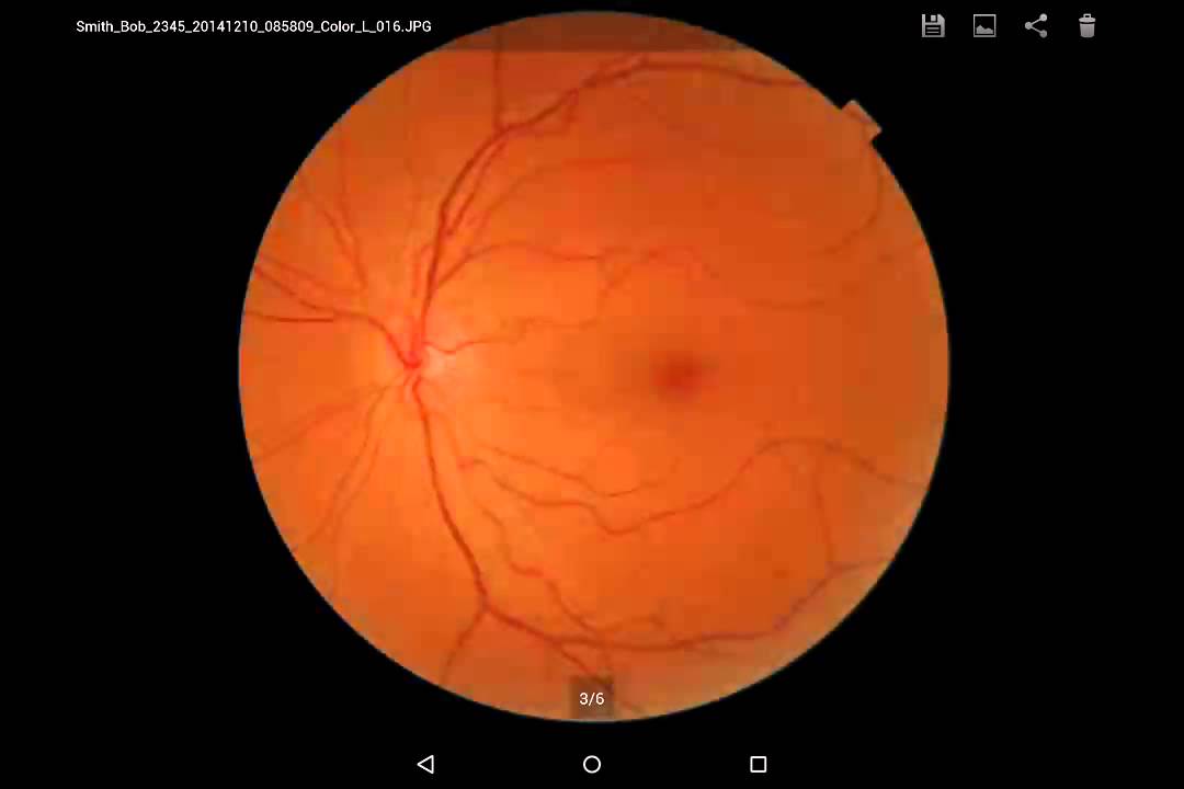 Topcon Nw-400 Android Tablet Tutorial - YouTube