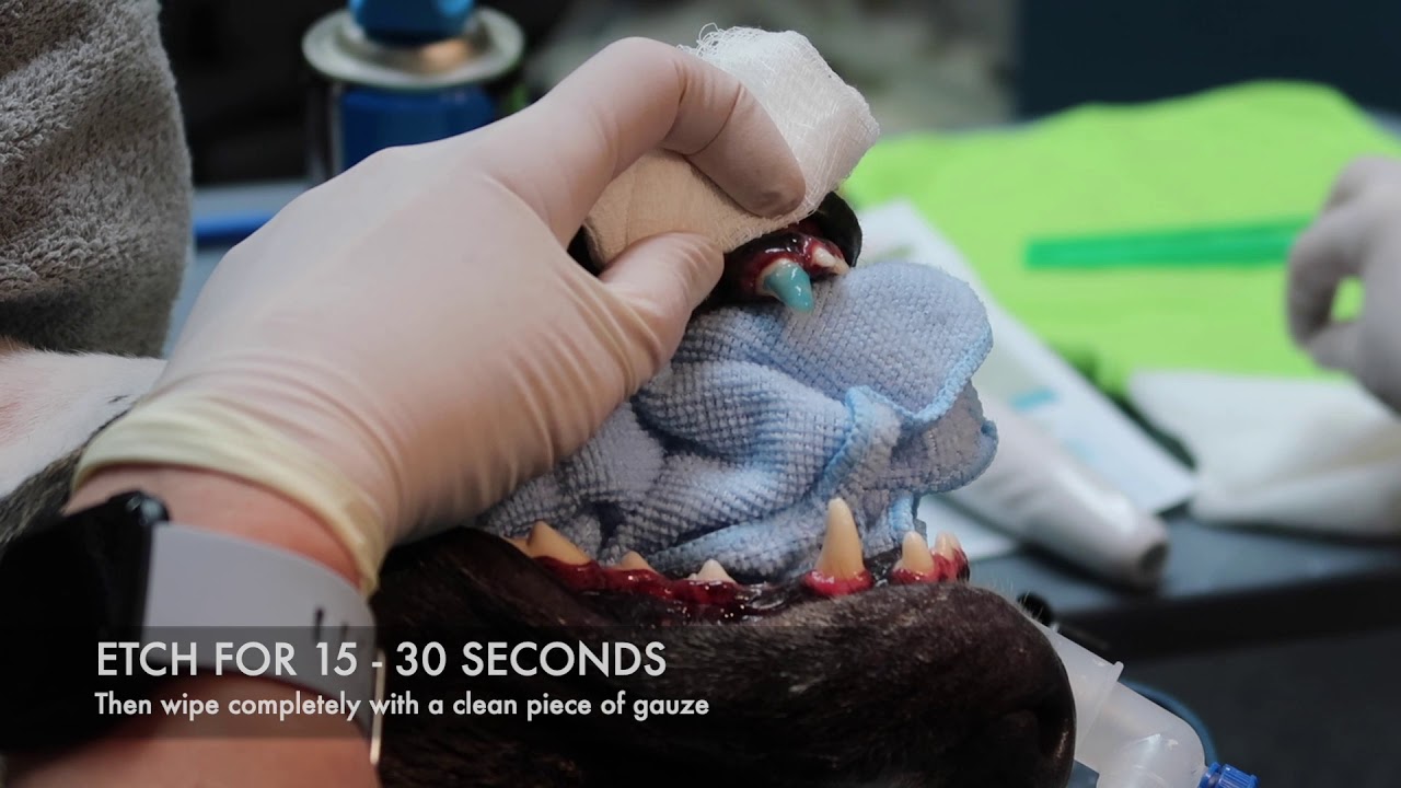 GingiShield™ Application V2 11 19 - YouTube