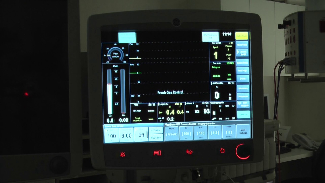 Setting the MAC alarms on a GE Aisys anaesthetic machine with v11 ...