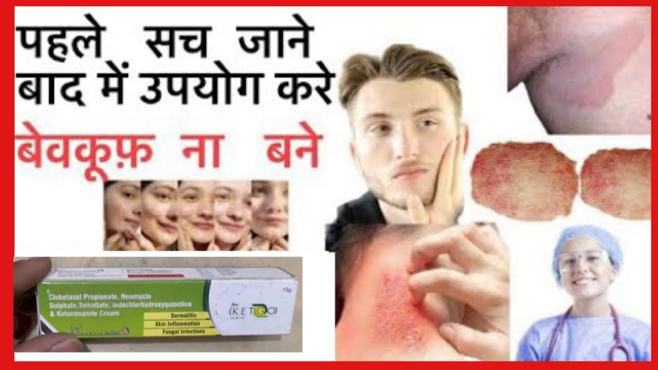 fungal infection daad khaj khujli ki dawa , skin infection treatment ...