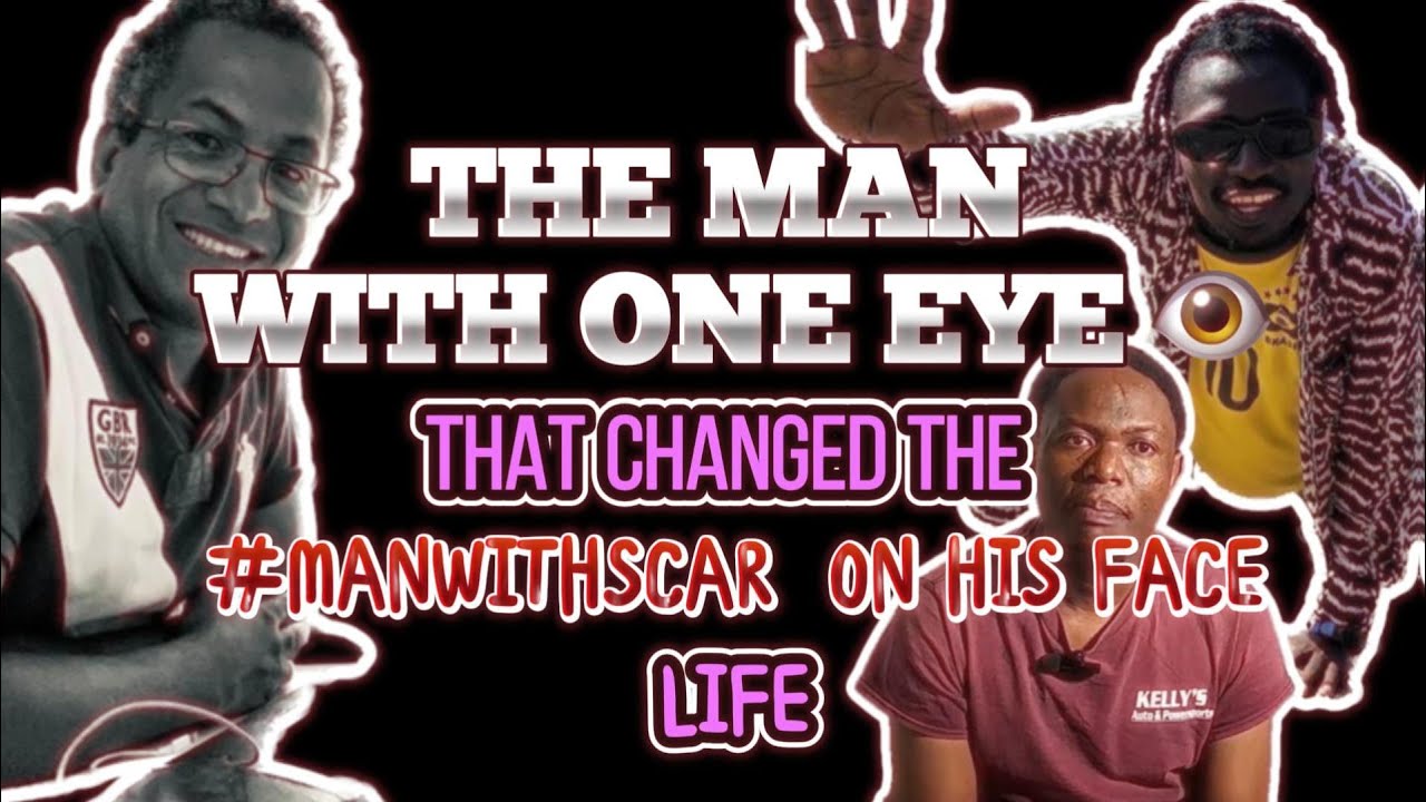THE MAN WITH ONE EYE THAT CHANGED THE #MANWITHSCAR ON HIS FACE LIFE ...