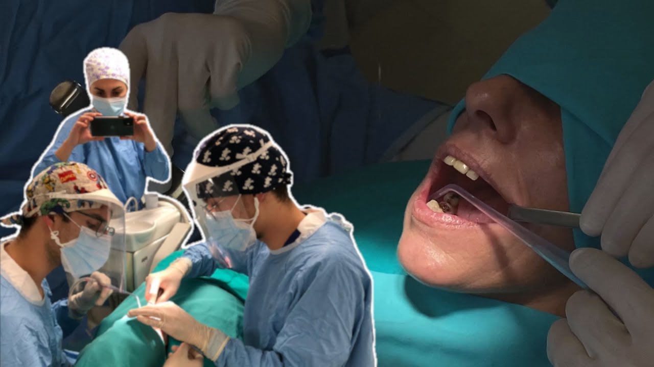 Caso clínico 1 | Extracción de restos radiculares - YouTube