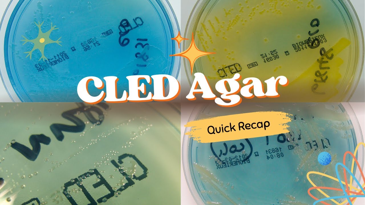 CLED Agar Quick Overview in Microbiology | Microbiology | Medical ...
