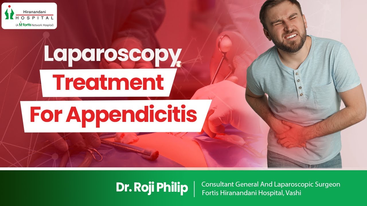 How Effective Is Laparoscopy in Treating Appendicitis? | Dr Roji Philip ...