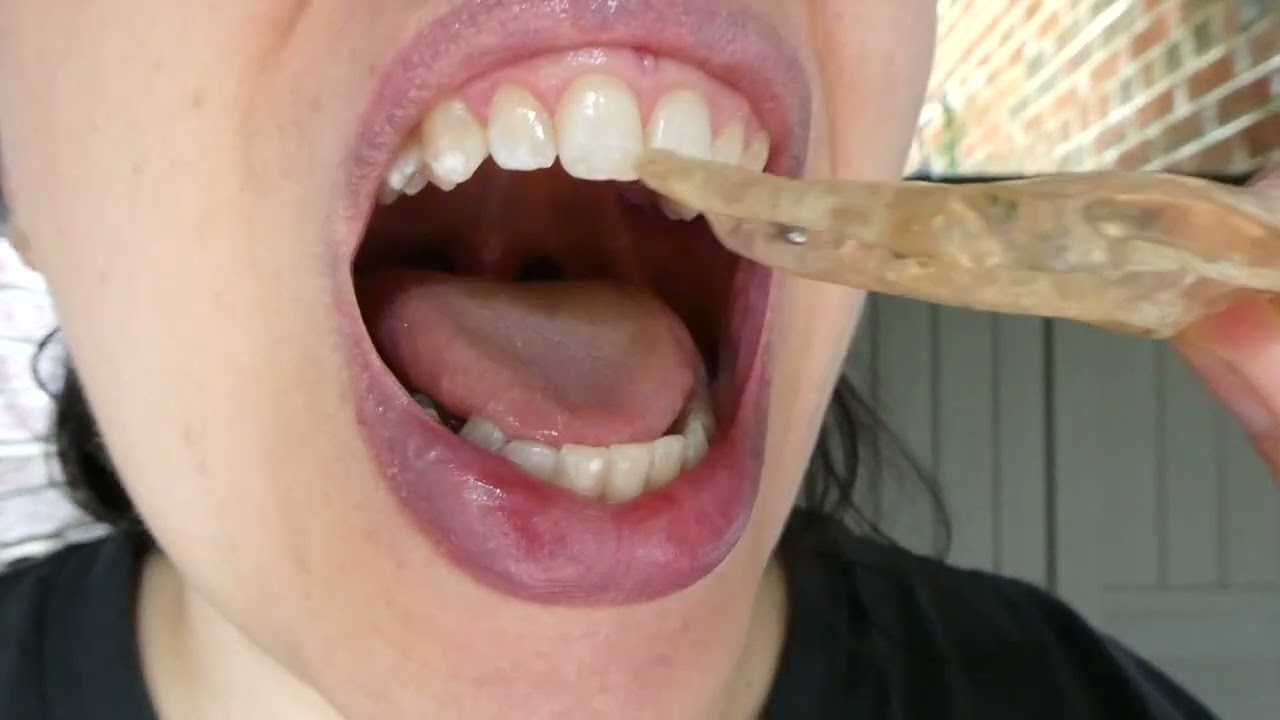 Old Retainer for Straightening Teeth Show Off! #teeth #retainer #mouth ...