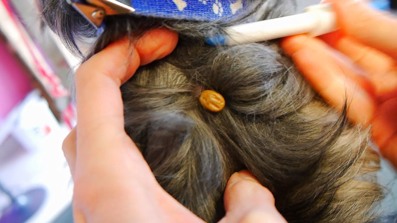How to Remove a Huge Tick - YouTube