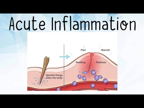 Inflammation Pathology |Acute Inflammation| - YouTube