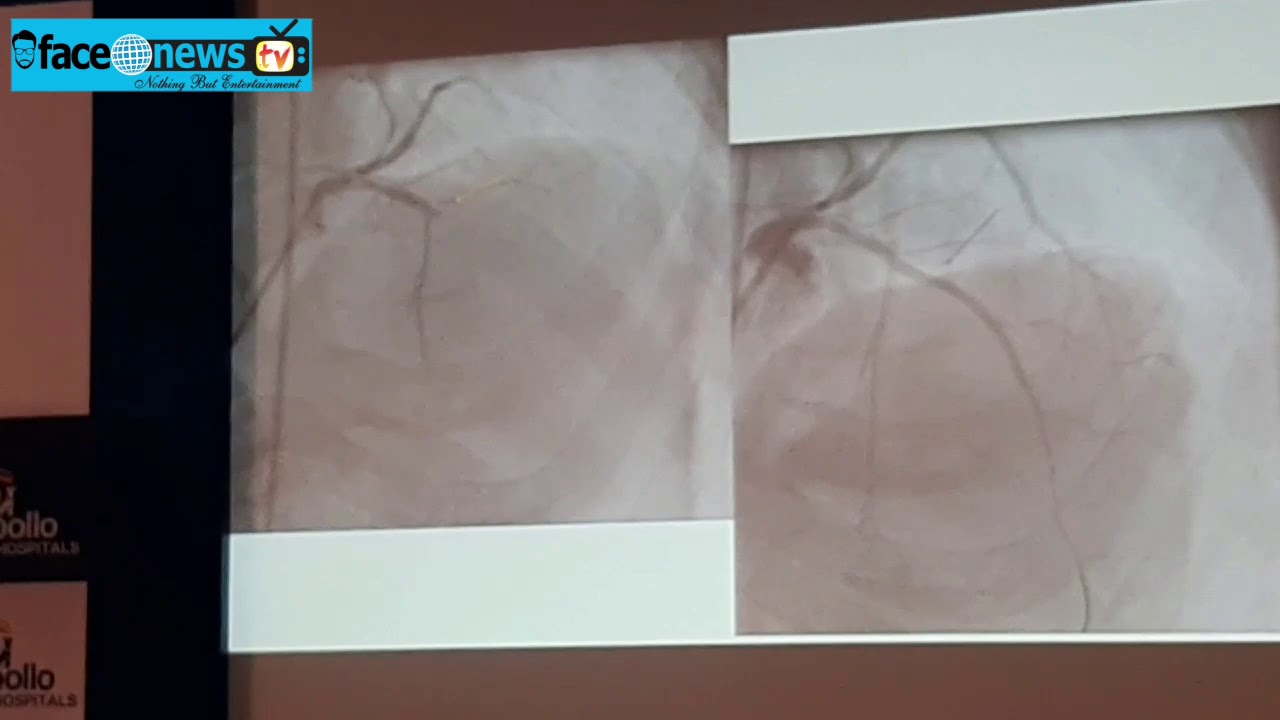 Apollo Hospitals OMR perform Lifesaving procedures on patient suffered ...