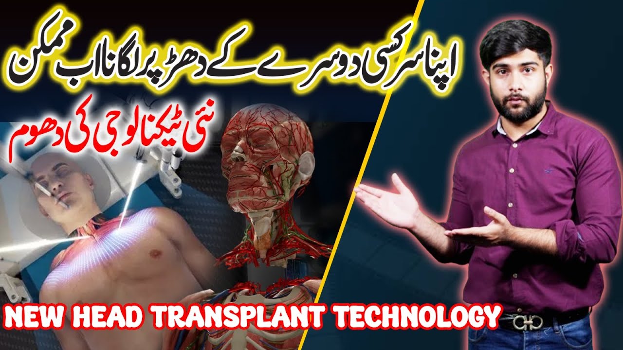 Mind-Blowing Science: Head Transplant Tech Changes Everything ...