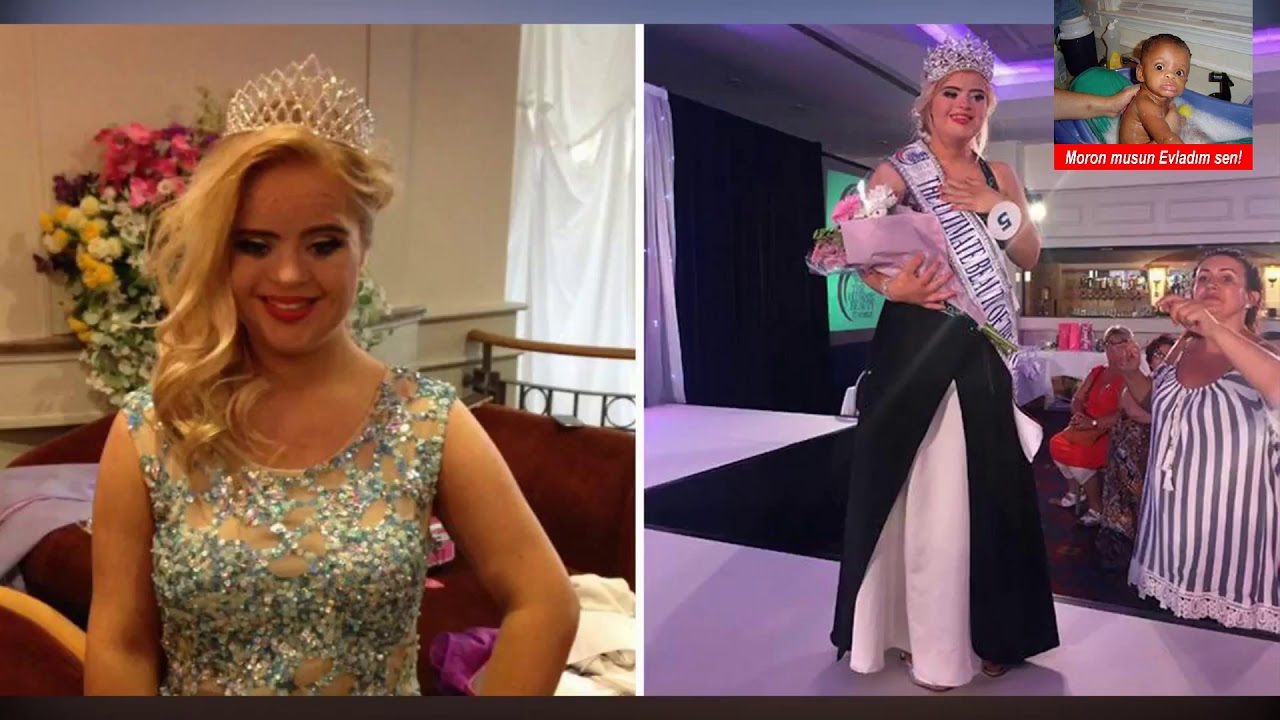 Girl with Down’s syndrome wins international beauty pageant ...