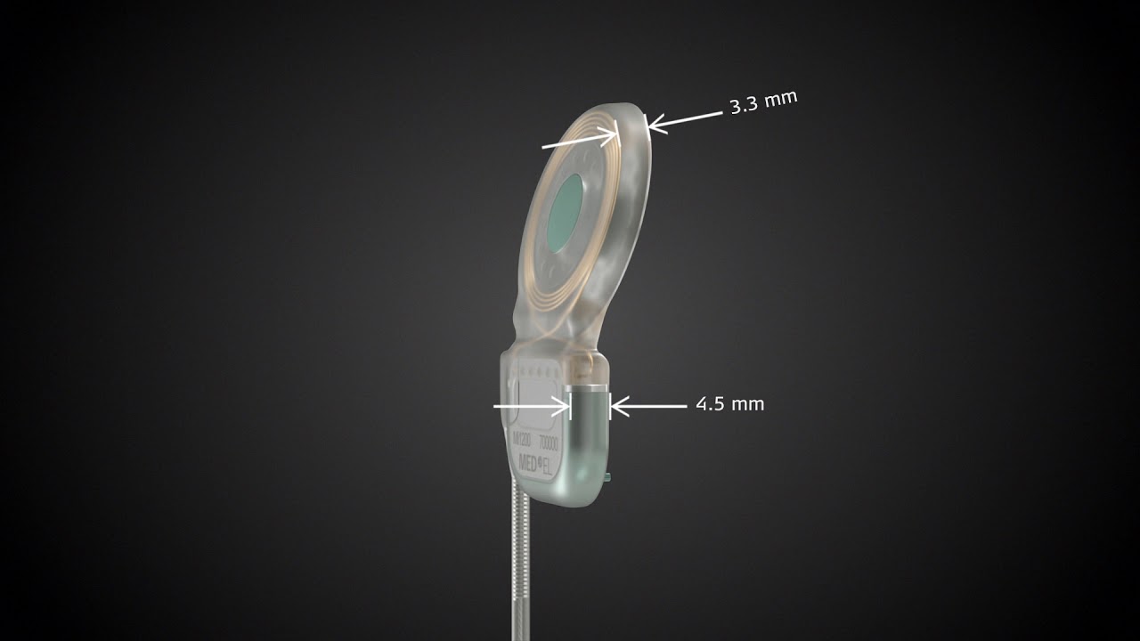 The MED-EL SYNCHRONY Cochlear Implant - YouTube